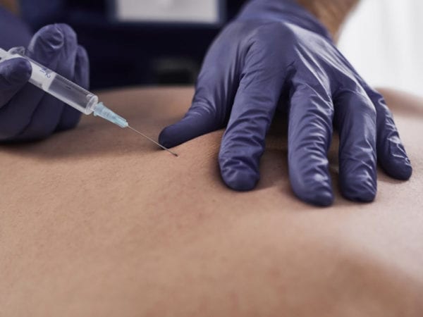 Soft Tissue Injections - Dr. Sam | Personal Injury and Trauma ...
