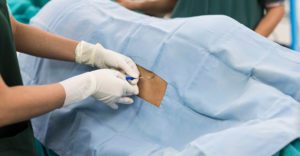 Soft Tissue Injections in San Antonio - Dr. Sam | Personal Injury and ...